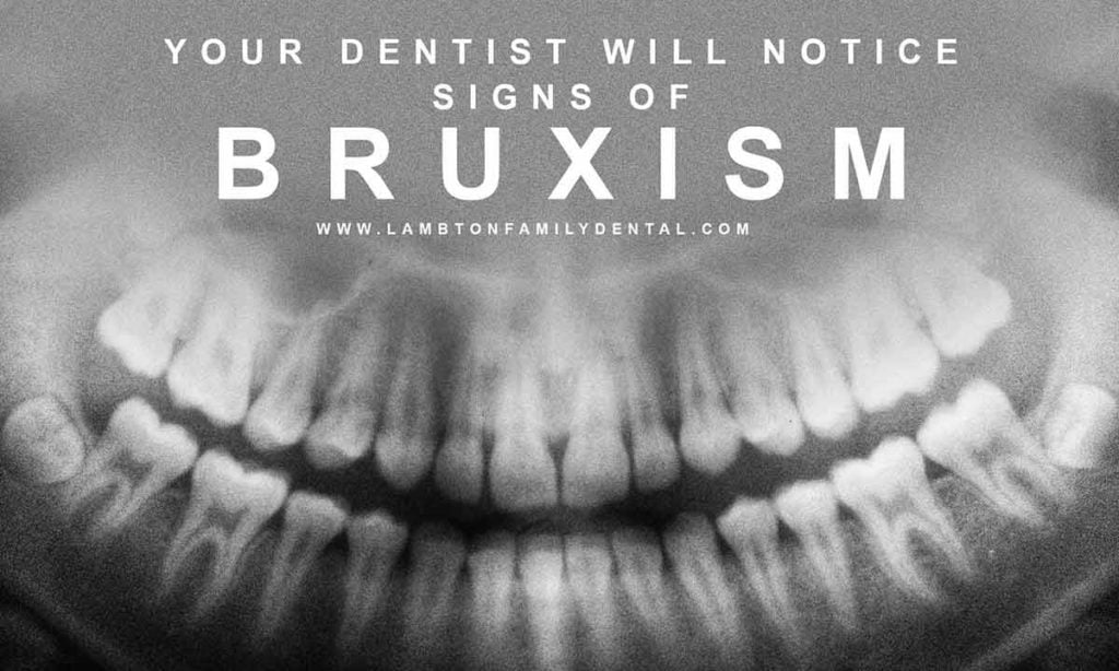 The Nightly Grind: Teeth Grinding Causes, Risks, Cures for Bruxism ...