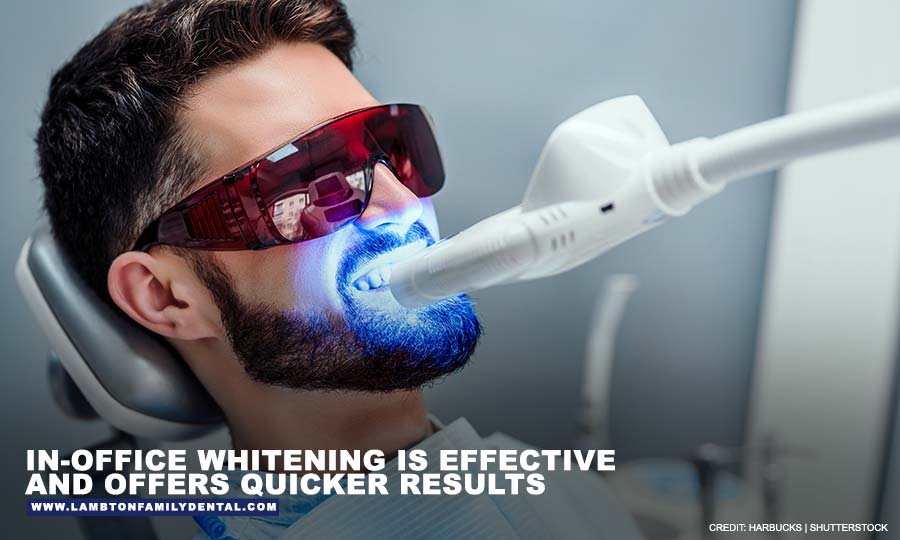 Are DIY Teeth Whitening Safe and Effective? | Lambton Family Dental