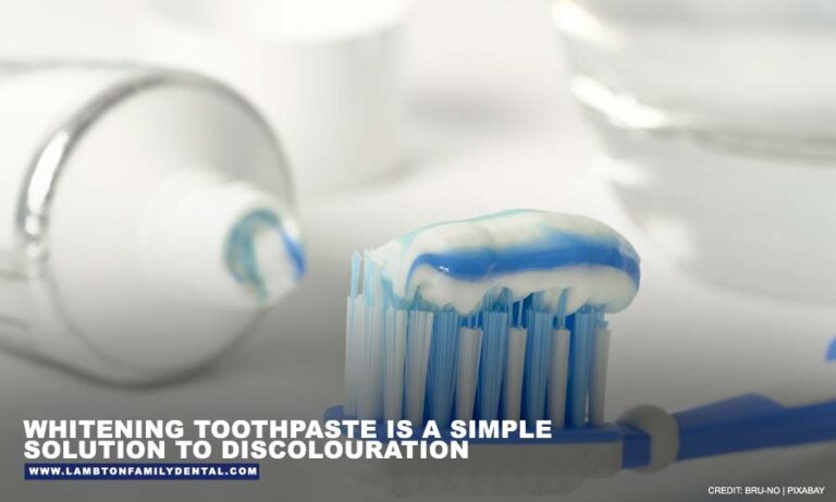 Are DIY Teeth Whitening Safe and Effective? | Lambton Family Dental