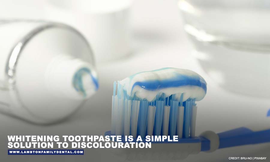 Are DIY Teeth Whitening Safe and Effective? | Lambton Family Dental